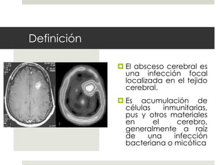 Absceso cerebral act ii | PPTX