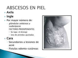 Absceso | PPT