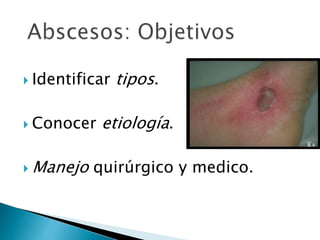 Absceso | PPT