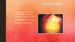 absceso completo PATOLOGIA Y TIPOS DE ABSCESOS.ppt