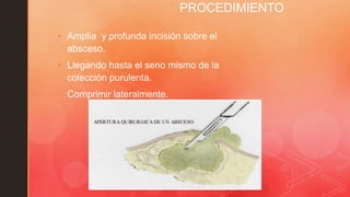 absceso completo PATOLOGIA Y TIPOS DE ABSCESOS.ppt