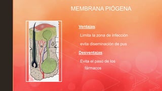 absceso completo PATOLOGIA Y TIPOS DE ABSCESOS.ppt