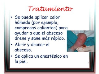 Absceso de la piel | PPTX