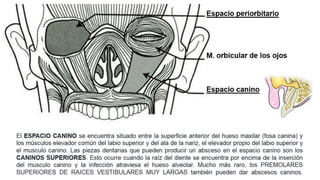 ABSCESO DEL ESPACIO CANINO | PPTX