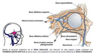 ABSCESO DEL ESPACIO CANINO | PPTX