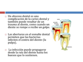 Absceso dentoalveolar agudo | PPTX