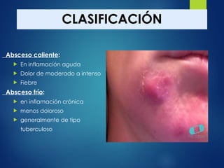 ABSCESO EN CARA RAUL CARDENAS TERAN .ppt