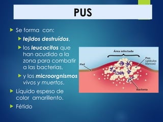 ABSCESO EN CARA RAUL CARDENAS TERAN .ppt