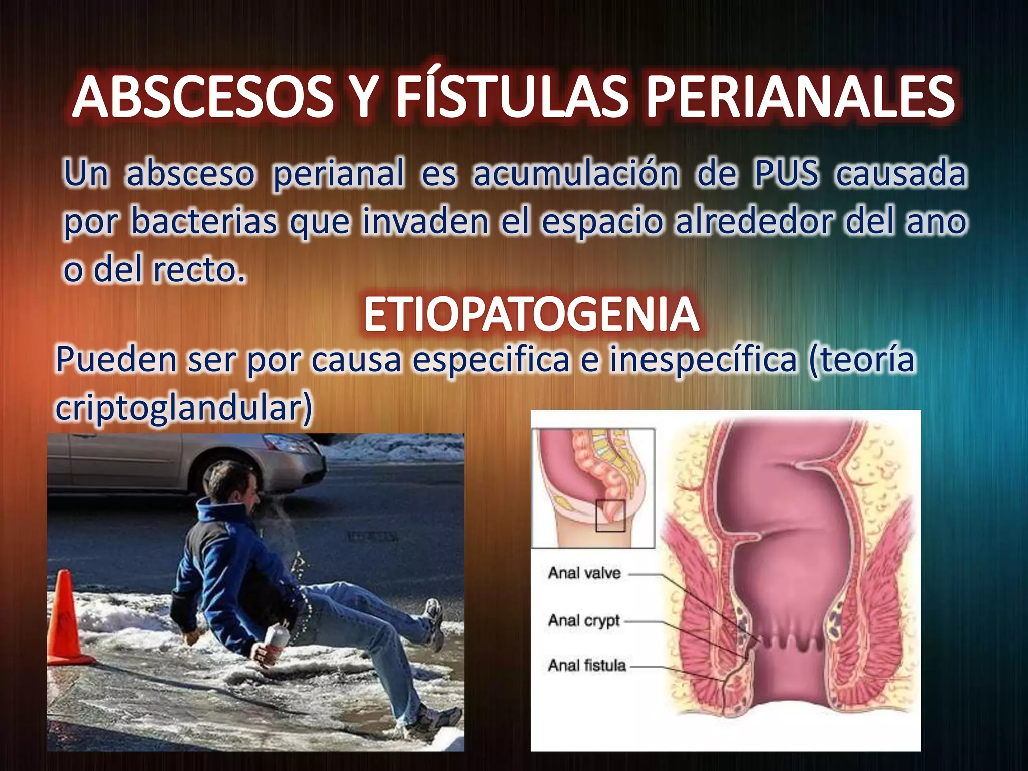 Absceso general | PPTX