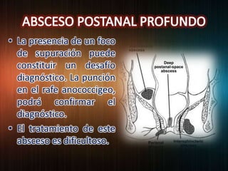 Absceso general | PPTX