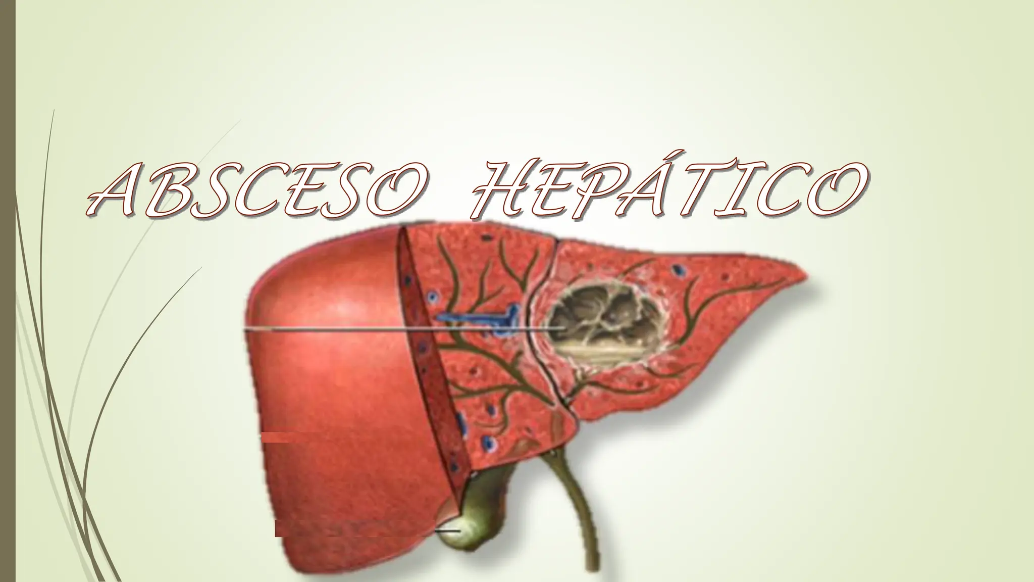ABSCESO HEPATICO en cirugia presentacion.pptx