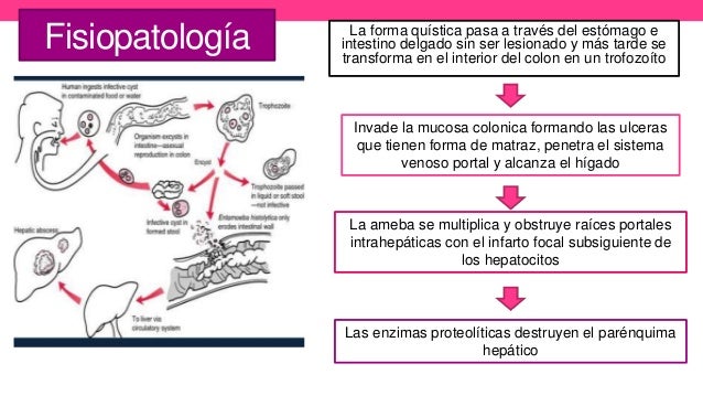 Absceso hepático: amibiano y piógeno
