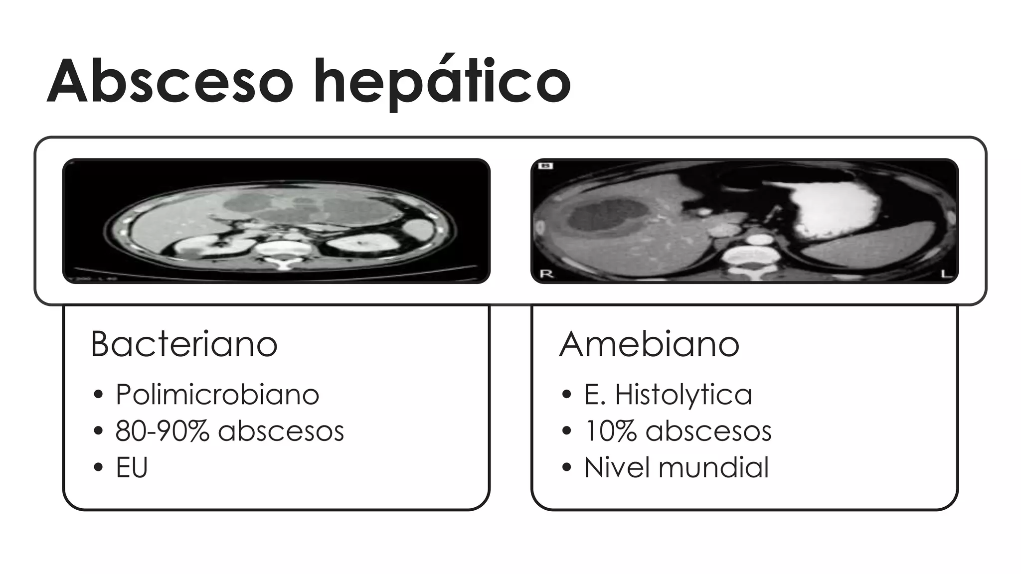 Absceso hepático amebiano y bacteriano | PPTX