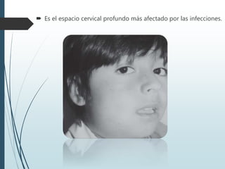Absceso parafaringeo, OTORRINOLARINGOLOGIA | PPTX