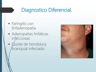 Absceso parafaringeo, OTORRINOLARINGOLOGIA | PPTX