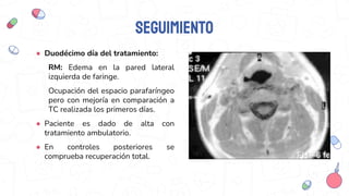 Absceso parafaríngeo | PPT