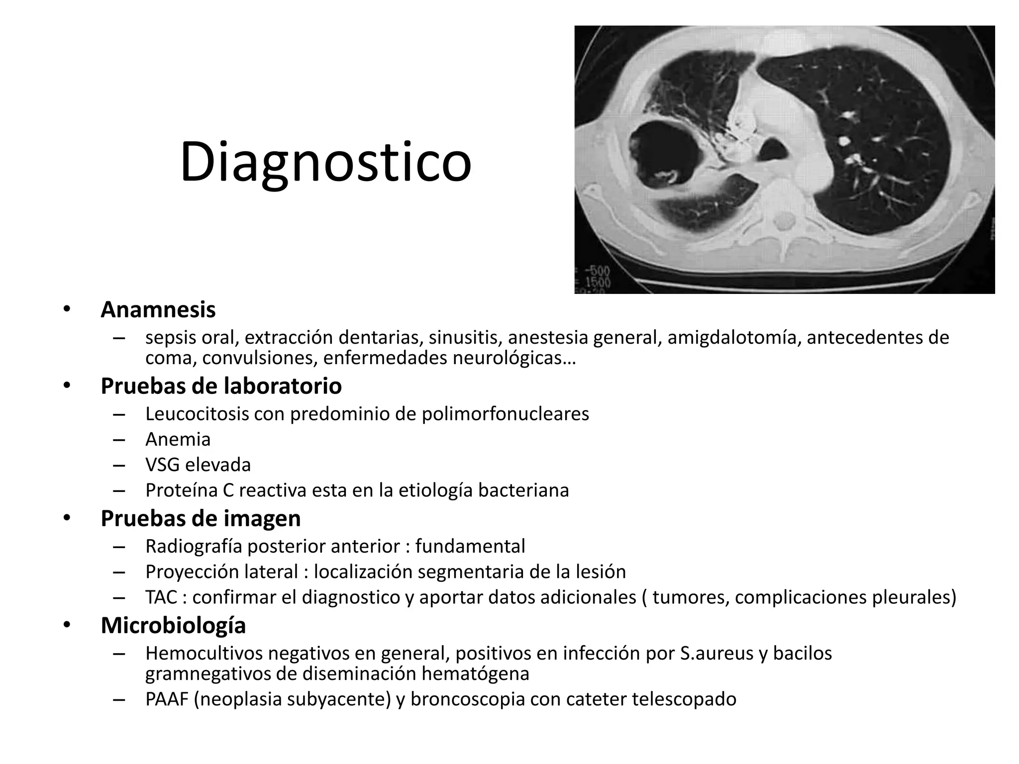 Absceso pulmonar | PPTX