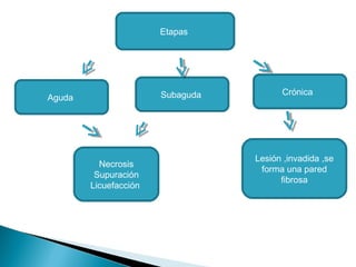 Absceso pulmonar | PPT