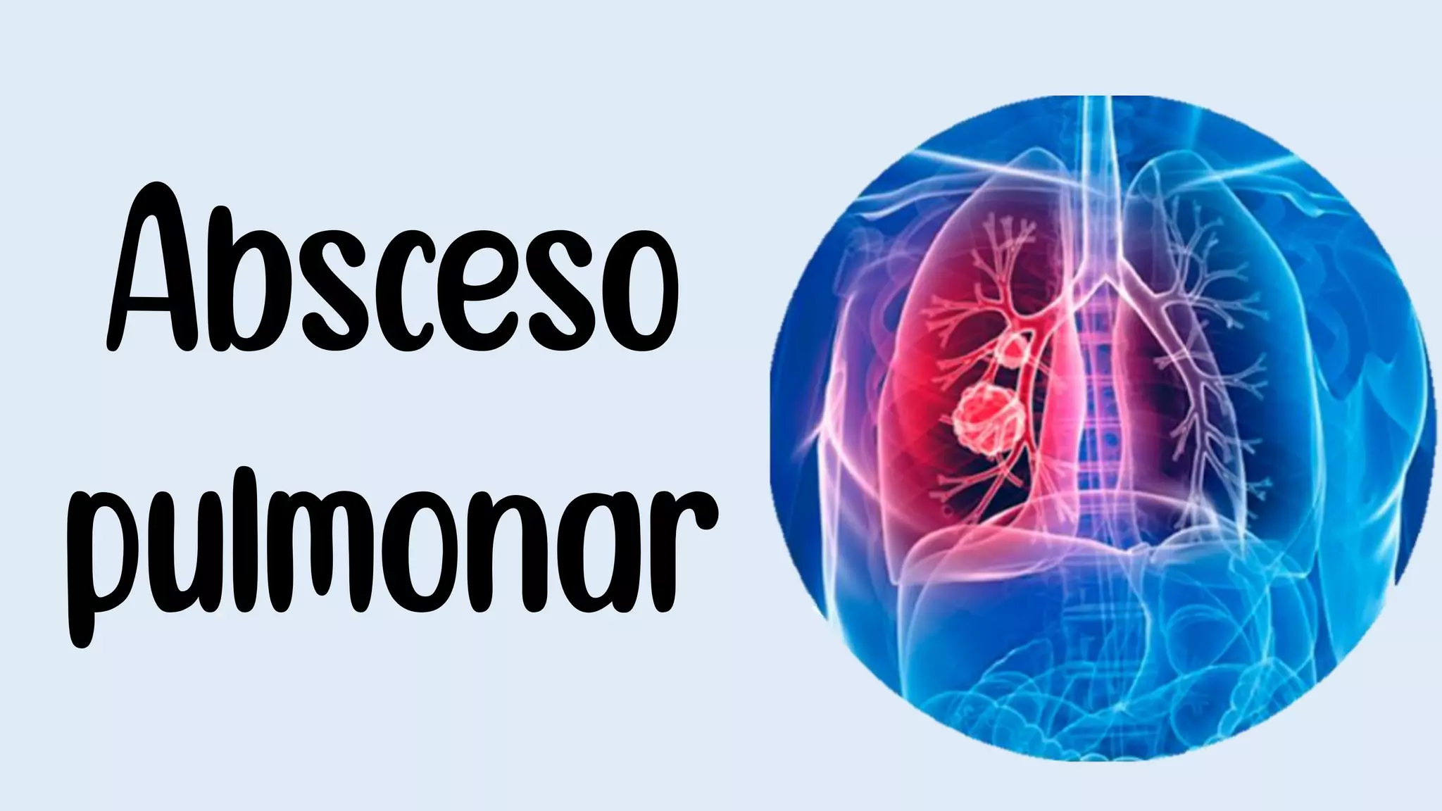 Absceso pulmonar.pdf