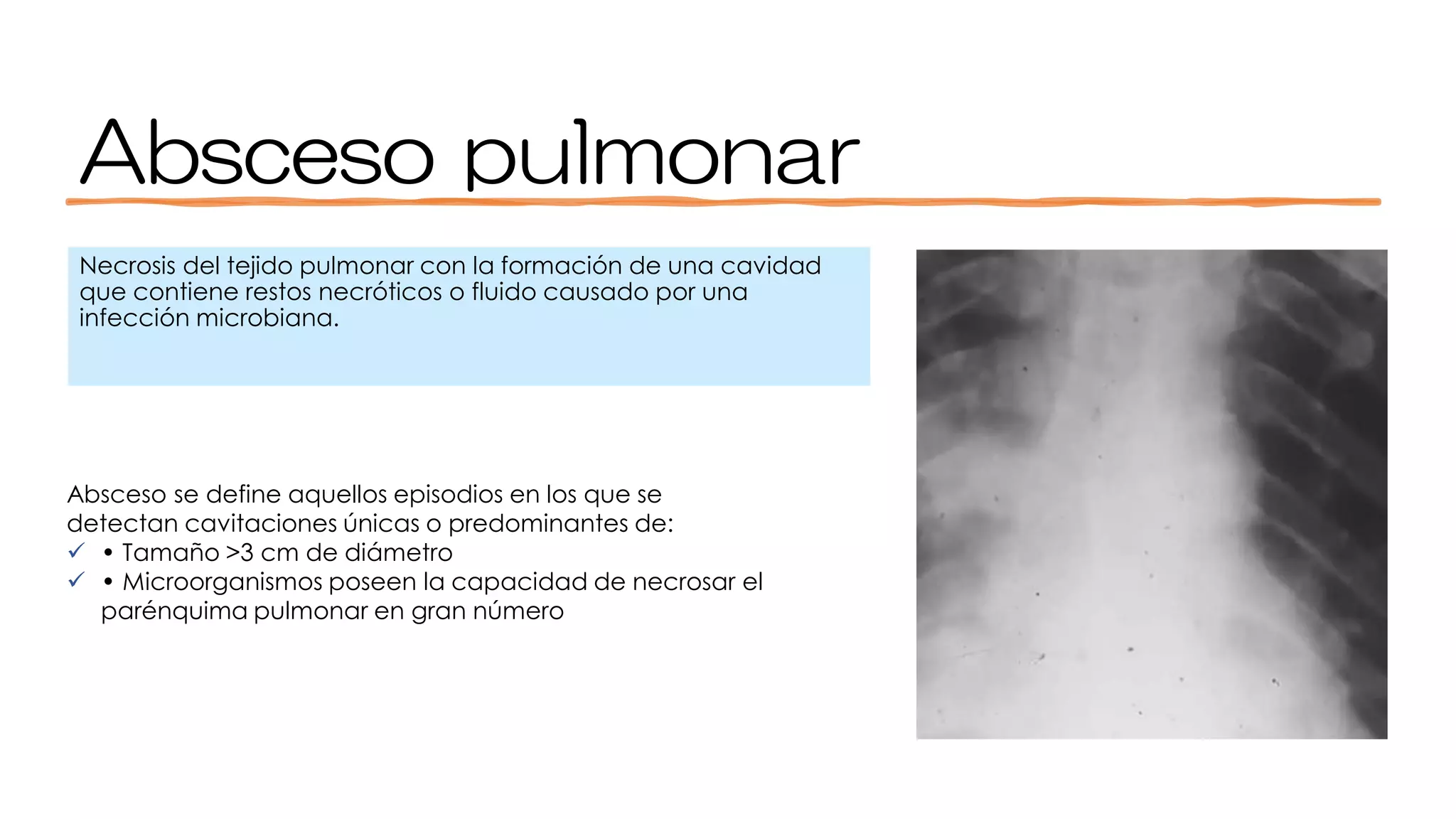 Absceso pulmonar.pdf