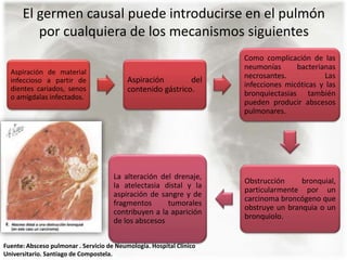 ABSCESO PULMONAR NEUMONOLOGIAAAAAAA.pptx