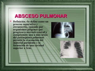 ABSCESO PULMONAR en los pacientes de la carrera de medicina.ppt