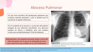 Absceso Pulmonar en pacientes hospitalizados.pptx