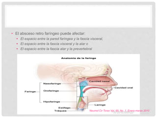 Absceso retrofaringeo | PPT