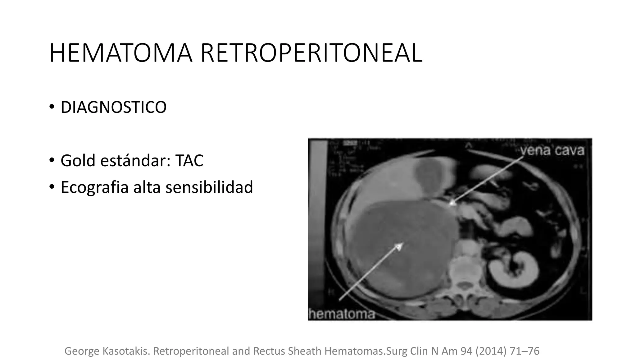 ABSCESO RETROPERITONEAL final.pptx