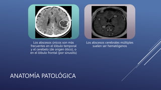 Abscesos cerebrales.pptx