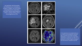 Abscesos cerebrales.pptx