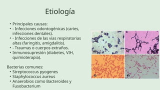Abscesos_Cervicales_Otorrinolaringologia_16_9.pptx_20241028_072858_0000 ...