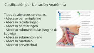 Abscesos_Cervicales_Otorrinolaringologia_16_9.pptx_20241028_072858_0000 ...