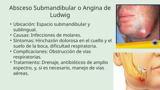 Abscesos_Cervicales_Otorrinolaringologia_16_9.pptx_20241028_072858_0000 ...