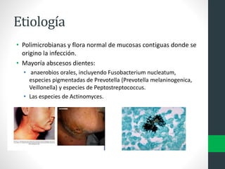 Abscesos de cuello | PDF