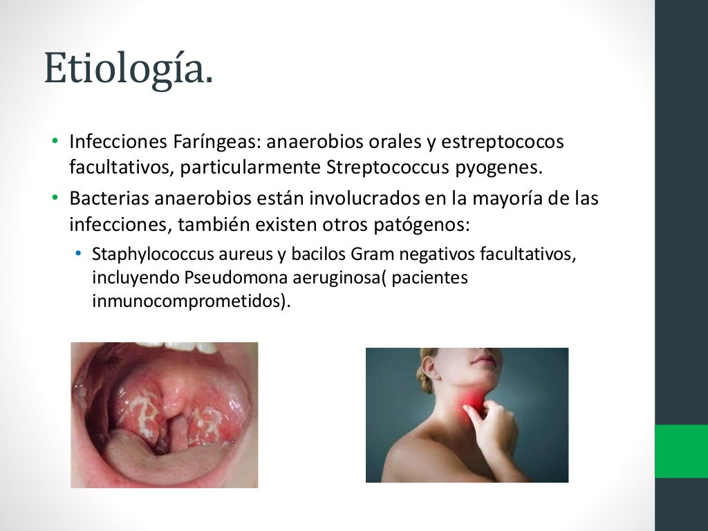 Abscesos de cuello