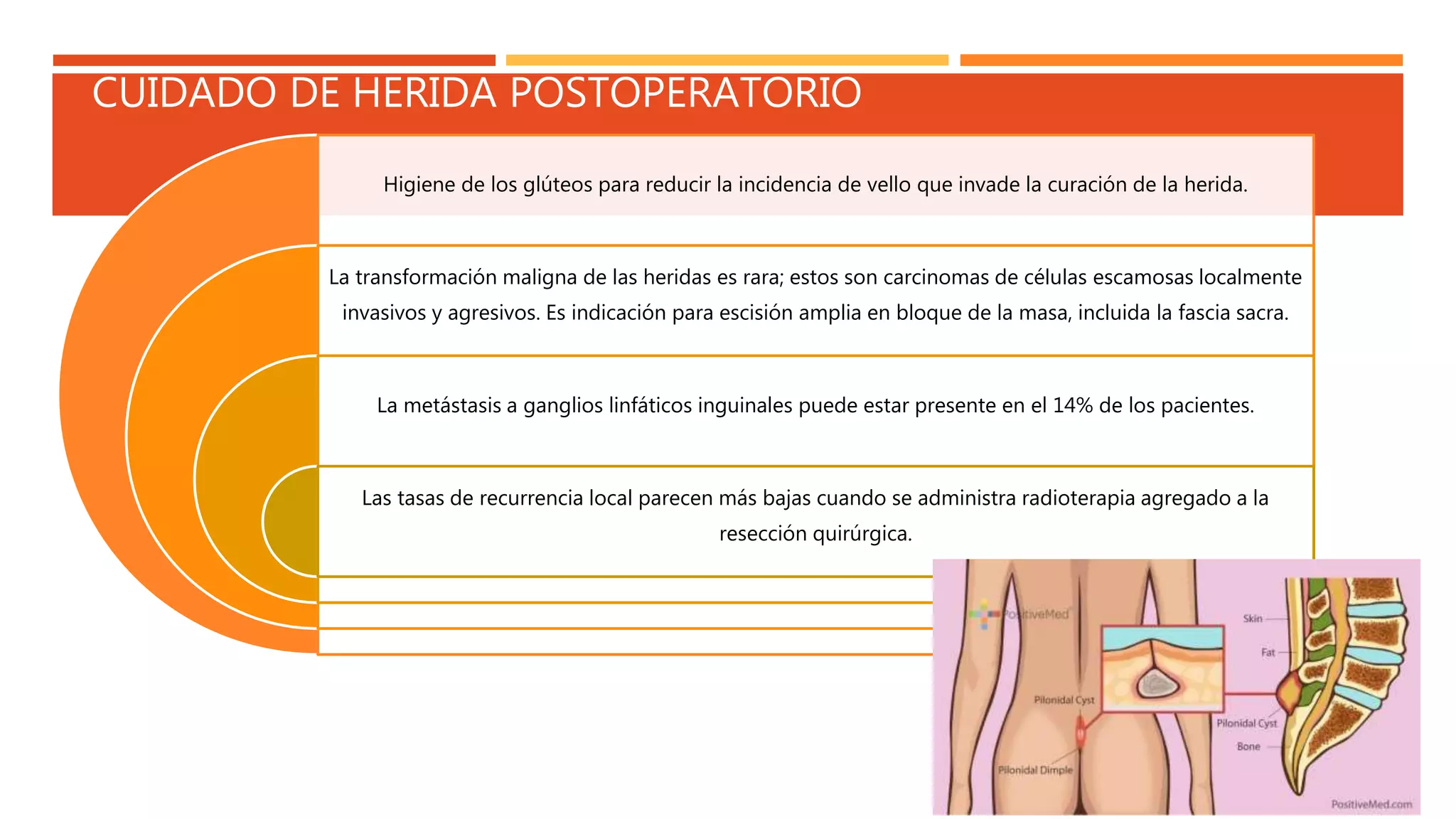 Abscesos, fistulas perianales y quiste pilonidal | PPTX