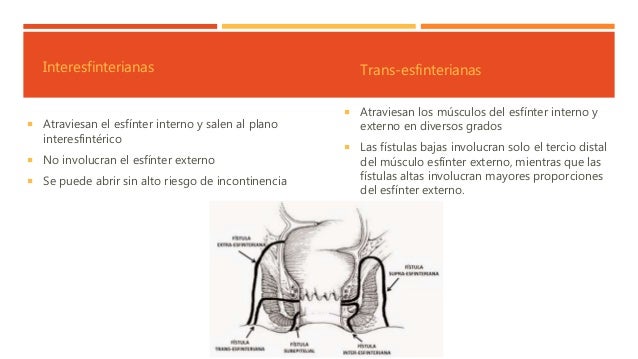 Abscesos, fistulas perianales y quiste pilonidal