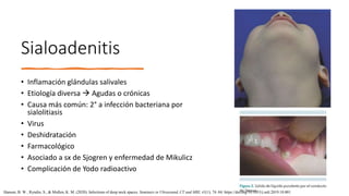 Abscesos Profundos de Cuello, CMN Siglo XXI | PPTX