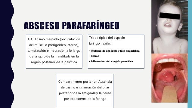 Abscesos profundos de cuello uamx