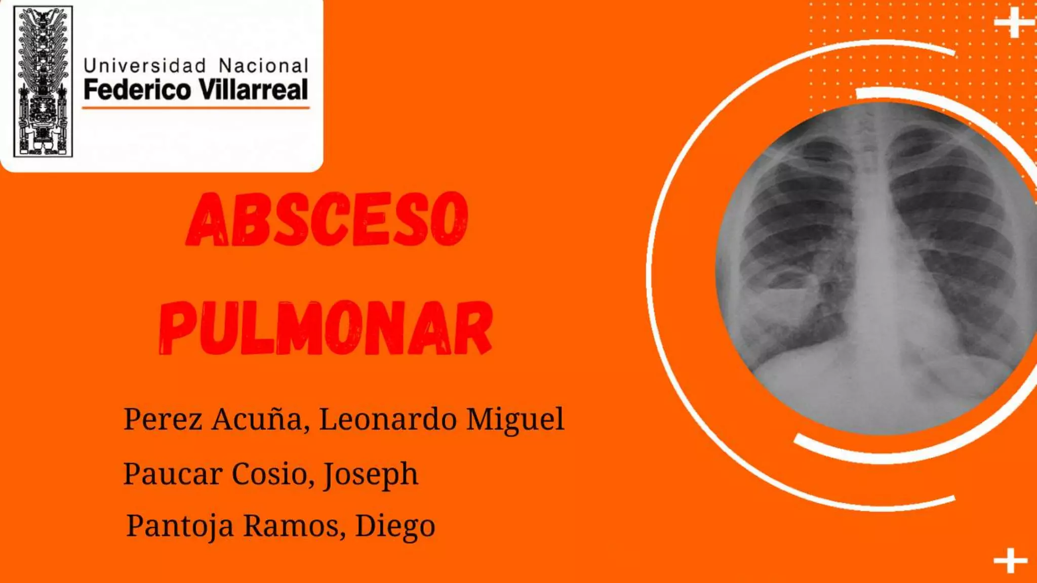 ABSCESOS PULMONARES | PPTX