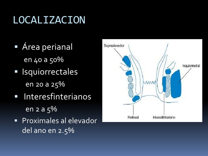 Abscesos y fistulas anales
