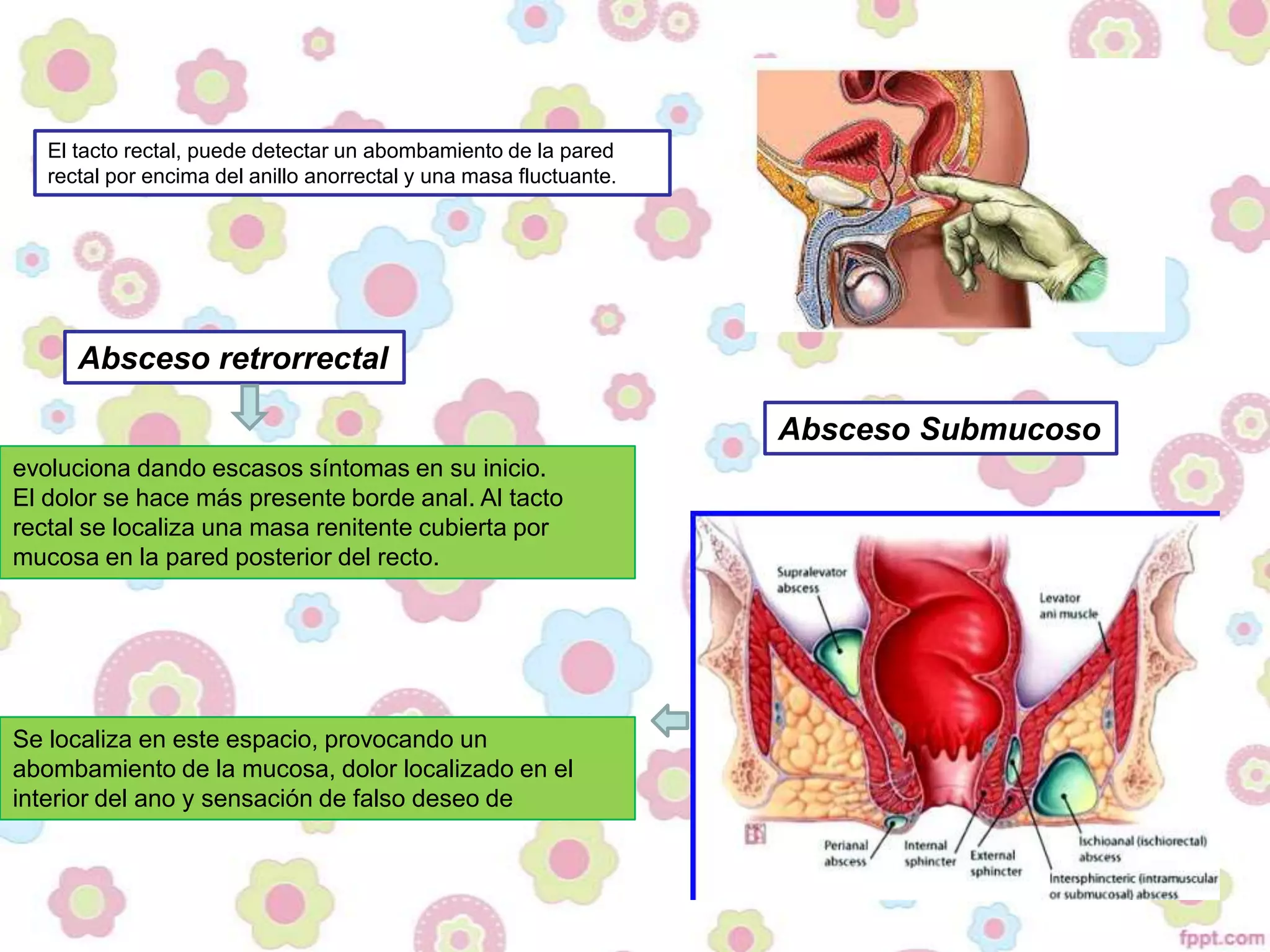 Abscesos y fistulas anorrectales | PPT