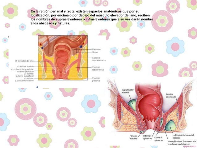 Abscesos y fistulas anorrectales | PPT
