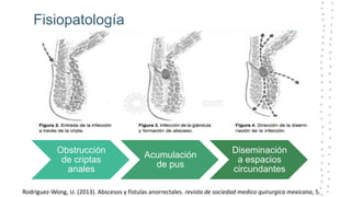 Abscesos y fistulas perianales e Hidradenitis supurativa.pptx