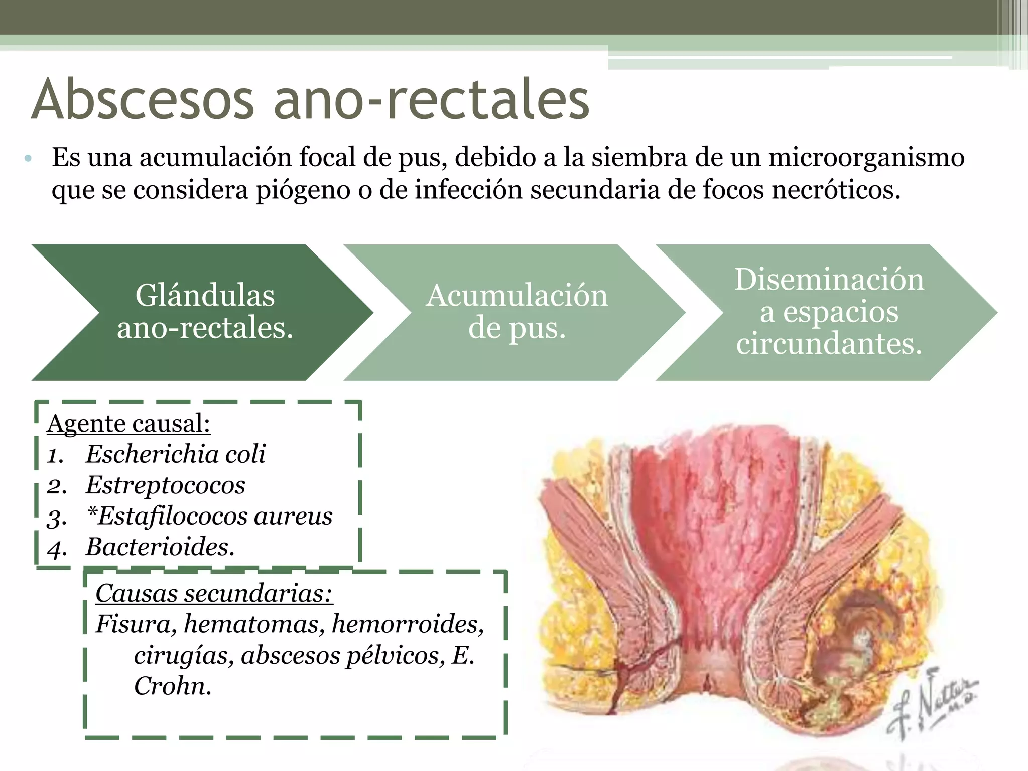 Abscesos y fístulas ano rectales