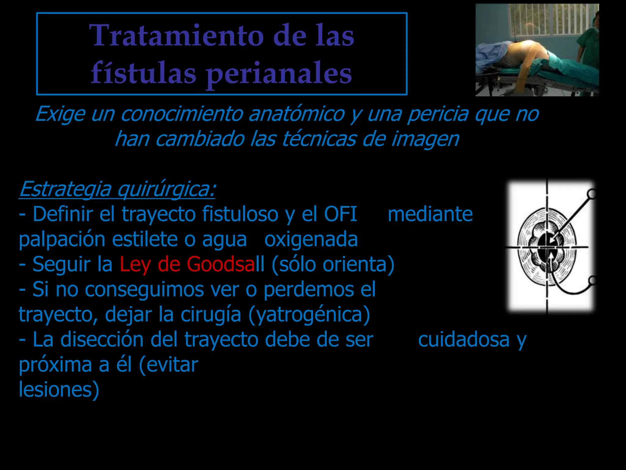 Abscesos y fístulas perianales | PPT