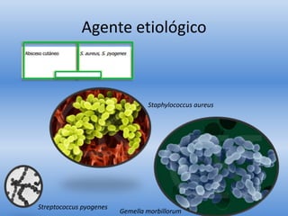 Abscesos y úlceras | PPTX