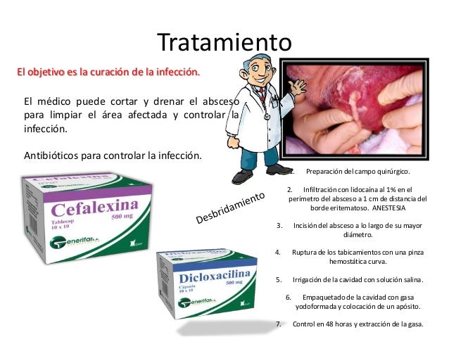 Abscesos y úlceras