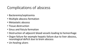 ABSCESS.pptx